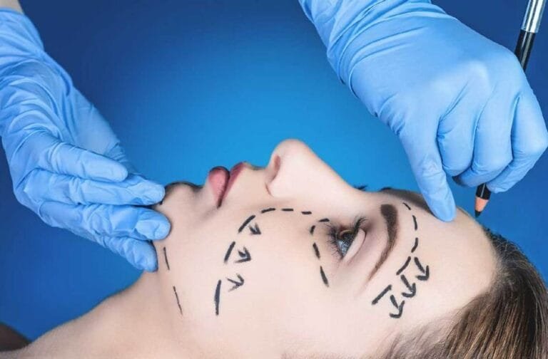 Facts about Degloved Face